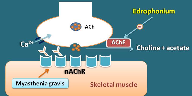 Tensilon test for diagnosis of Myasthenia gravis
